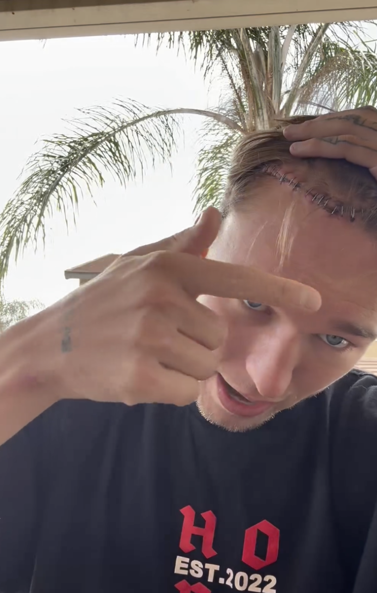 Austin Forkner Injury Update - Brain Surgery - Motocross